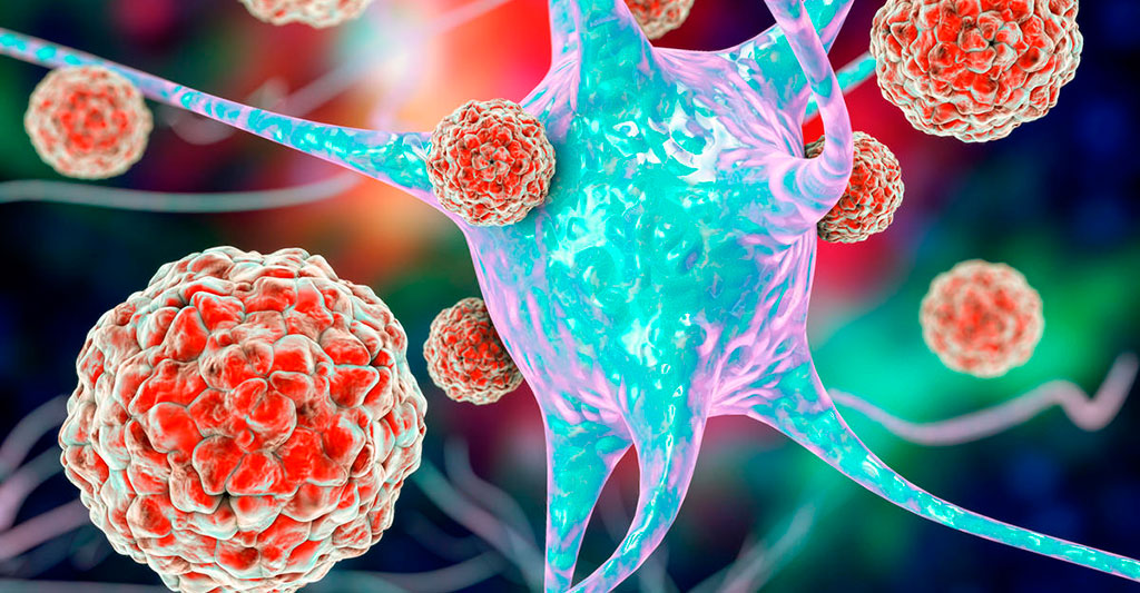 Un nuevo estudio identifica una posible causa de enfermedad similar a ...